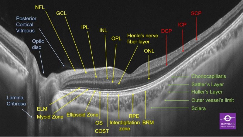Diagram of the Normal Retina and Choroid Structural Layers - TowardPi ...
