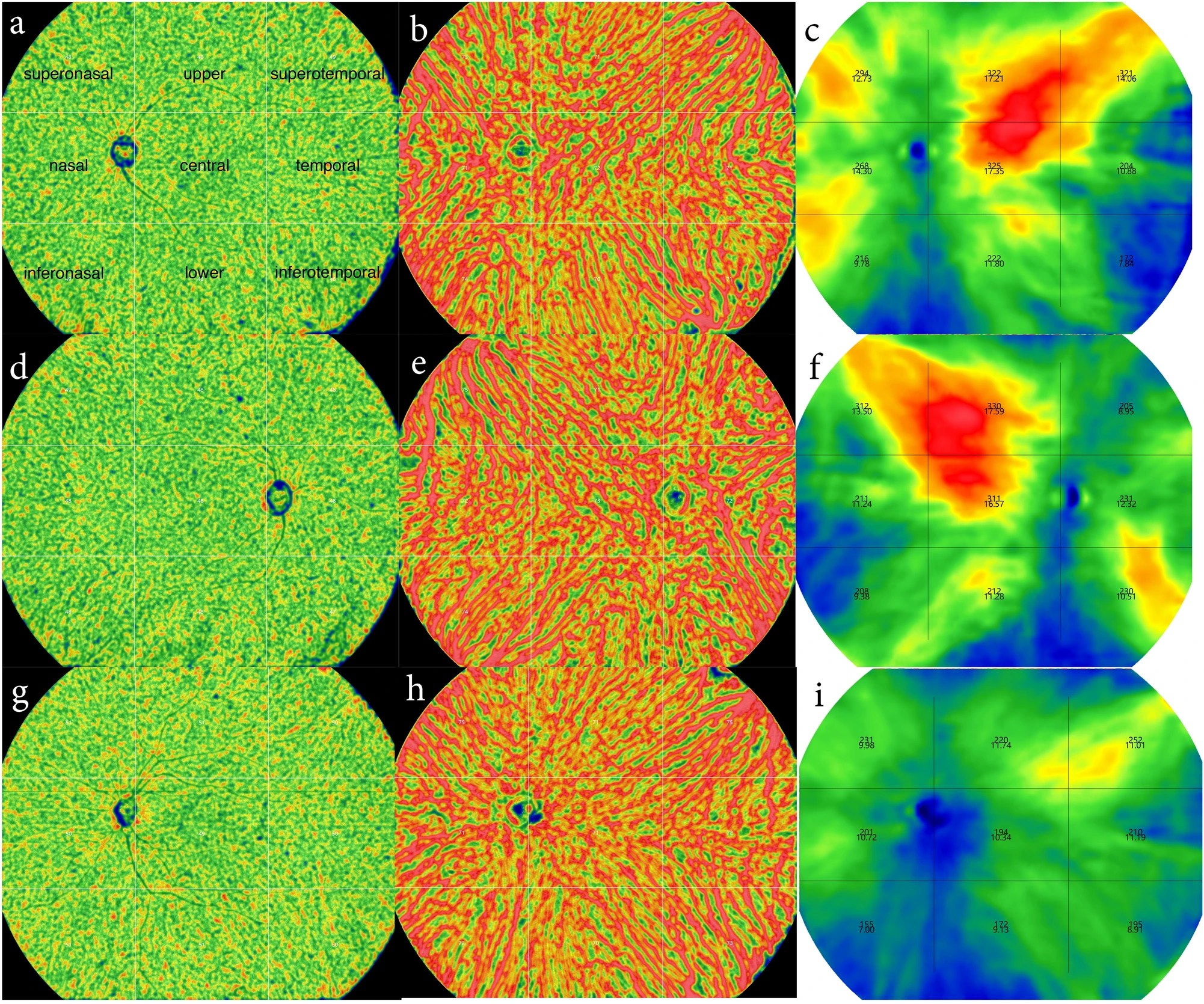“Our Study May Provide Further Evidence for the Congestion of Vortex ...