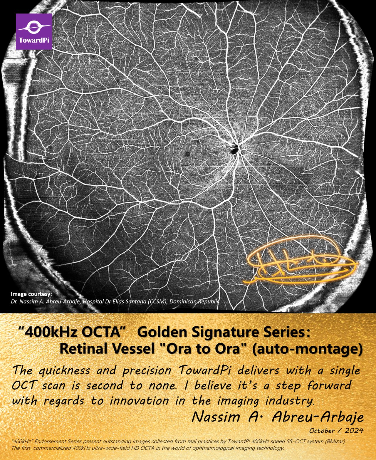 Retinal Vessel “Ora to Ora” Captured by 400kHz SS /OCTA - TowardPi Medical