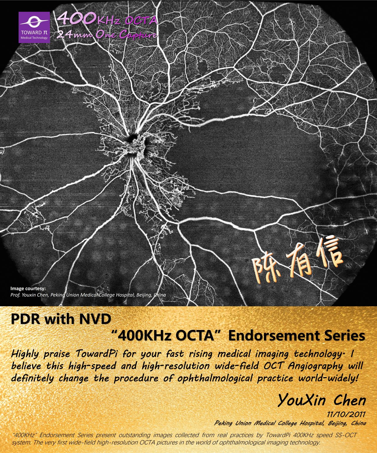PDR with NVD 400KHz OCTA - TowardPi Medical