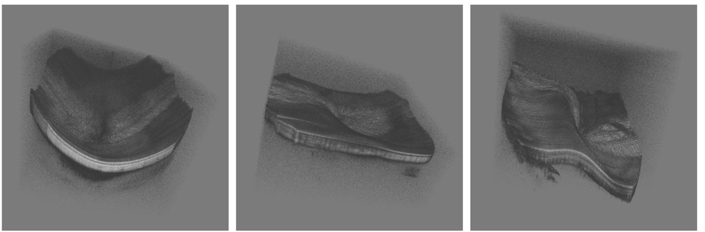 A Wireless Battery-free Eye Modulation Patch for High Myopia Therapy ...