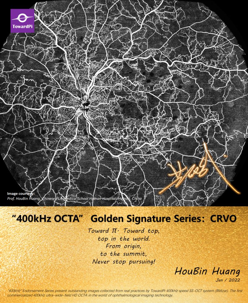 Central Retinal Vein Occlusion, OCTA Single Scan - TowardPi Medical