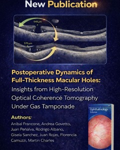 A study that Completely Changes the Postoperative Management of Macular ...