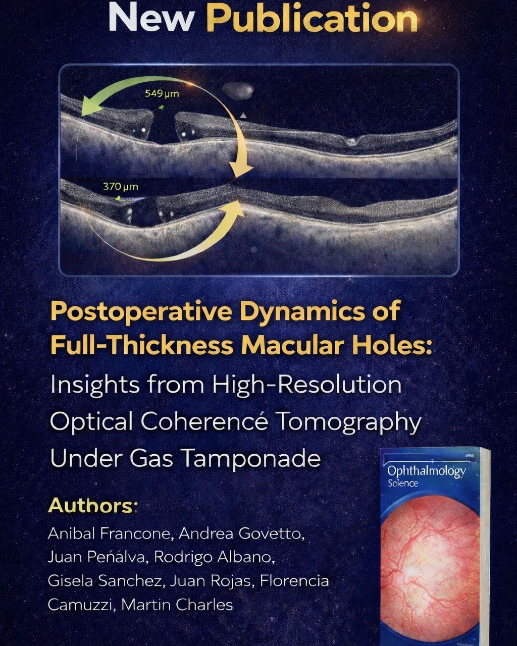 A study that Completely Changes the Postoperative Management of Macular ...