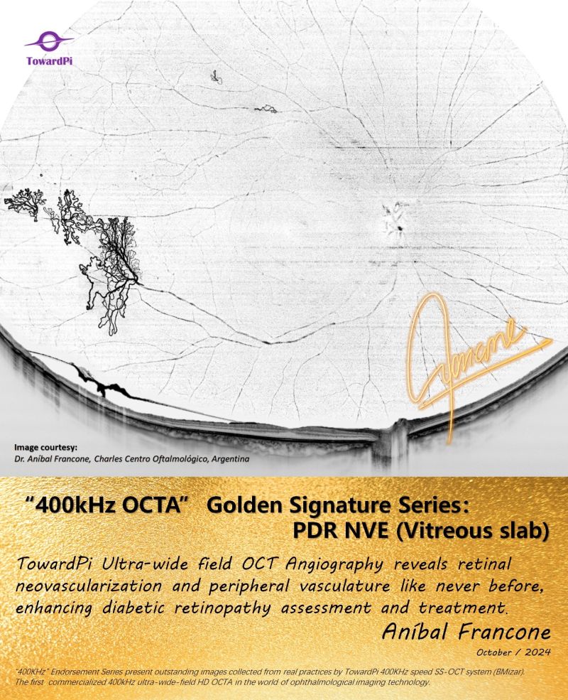 Retinal Neovascularization in PDR Captured with 400kHz SS-OCT/OCTA ...