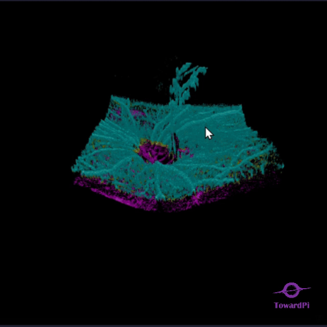 3D vessel of NVD captured by TowardPi OCT - TowardPi Medical