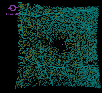 3D Blood Vessels Rendering is Commercially Available! TowardPi Offers ...