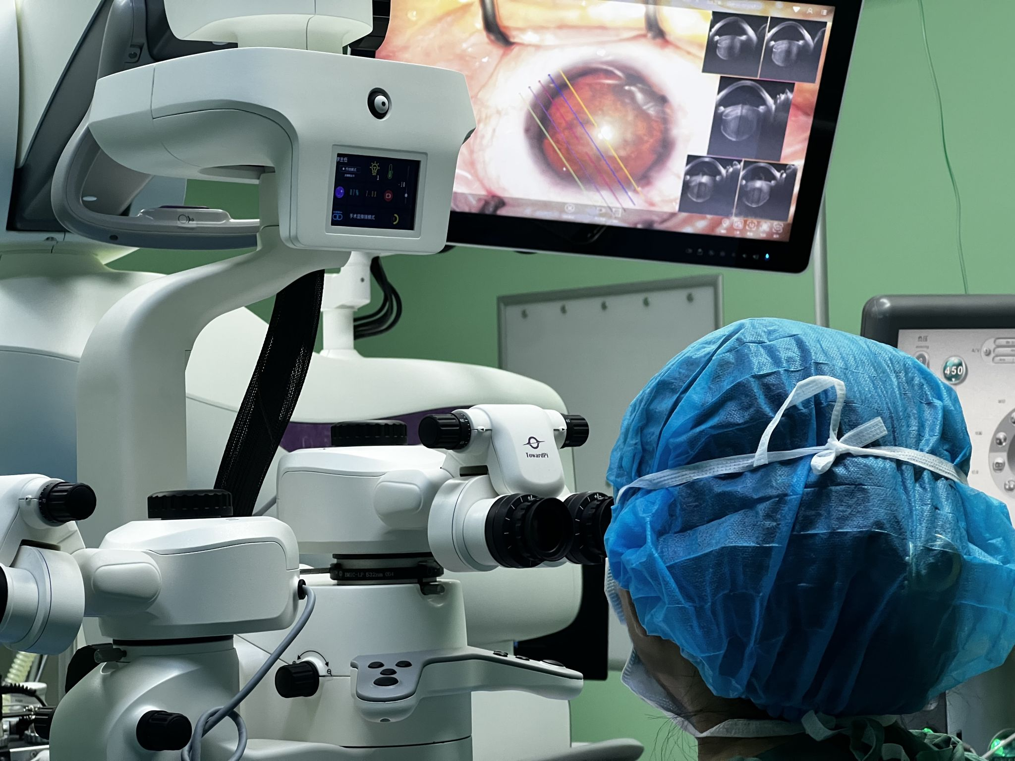 TowardPi's New Intraoperative OCT Microscope - TowardPi Medical